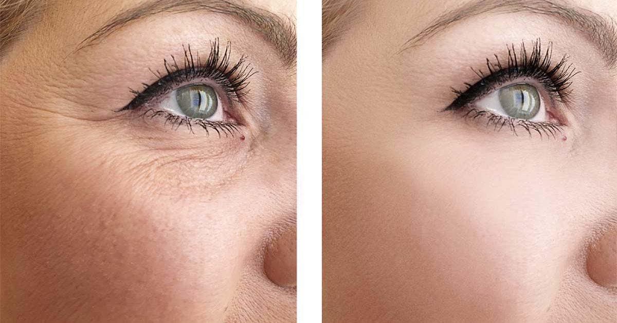 6 remèdes de grand-mère contre les yeux fatigués