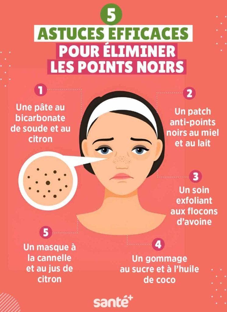 5 astuces pour enlever les points noirs du visage