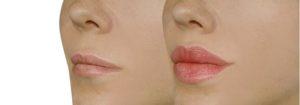 Comment modifier la forme de ses lèvres avec la technique de l’overlining