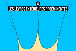 Les 9 différents types de vagin : Guide complet 2023