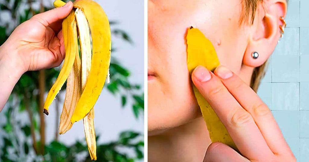 Comment utiliser la peau de banane pour prendre soin de la peau
