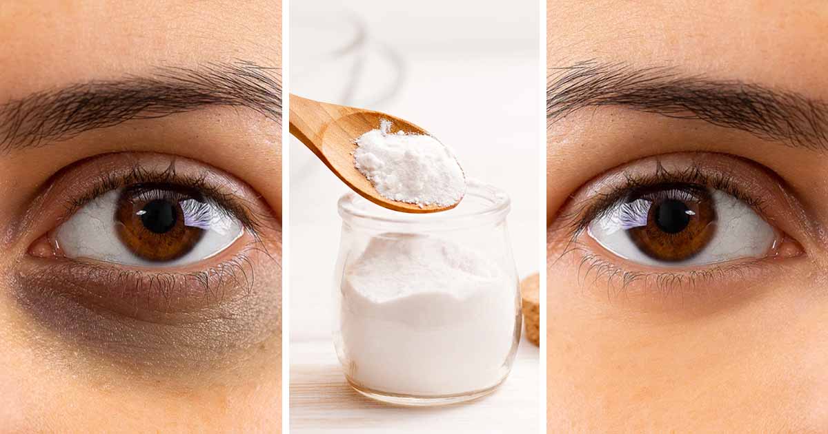 5 astuces de grands-mères pour estomper les cernes sous les yeux