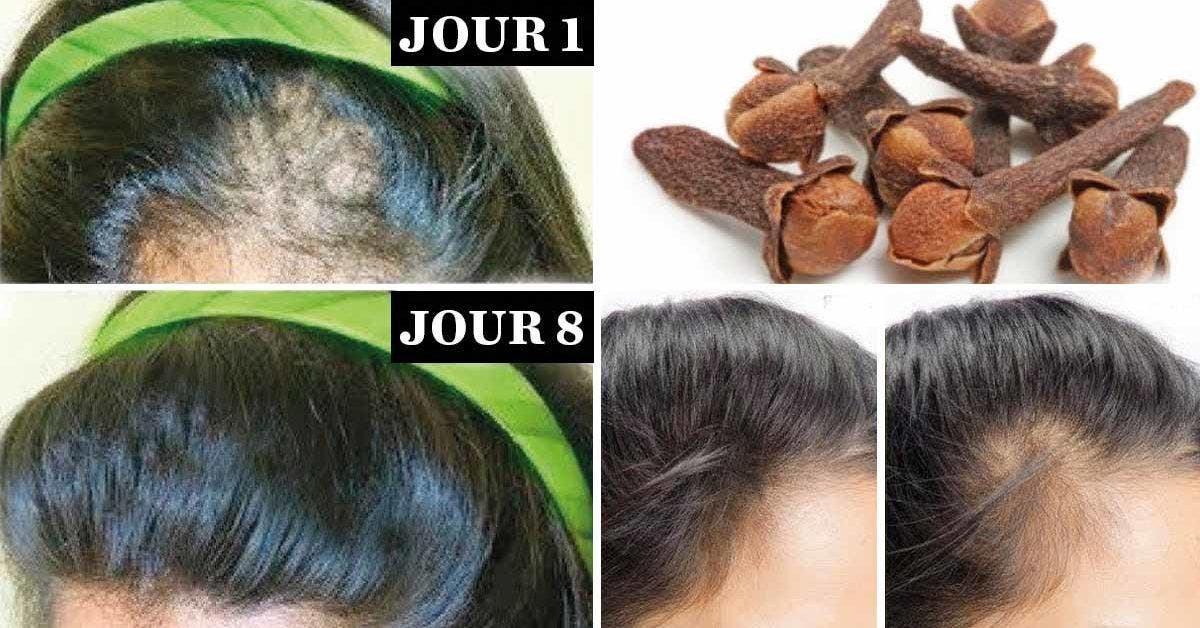 Clou de girofle : 4 bienfaits et utilisations pour les cheveux
