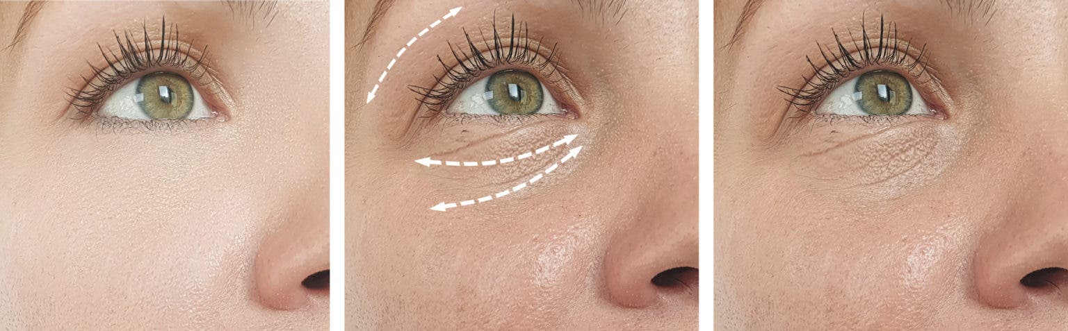 3 masques maison pour rajeunir le contour des yeux