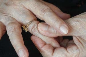Comment retirer une bague du doigt sans douleur