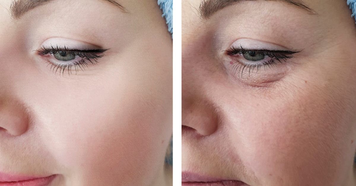 3 masques maison pour rajeunir le contour des yeux